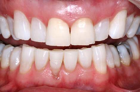 Best Dentistry Atlanta & Decatur, GA | Signature Smiles Studio